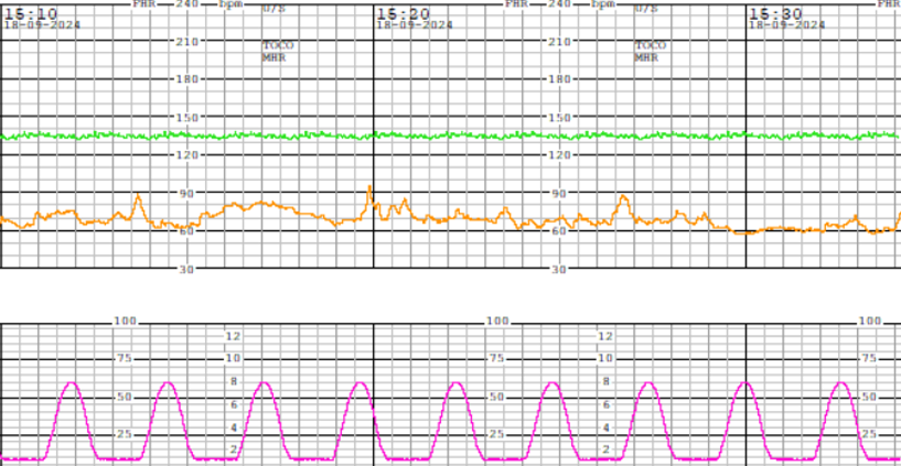9Int_Tracings | OBIX P.O.E.T.
